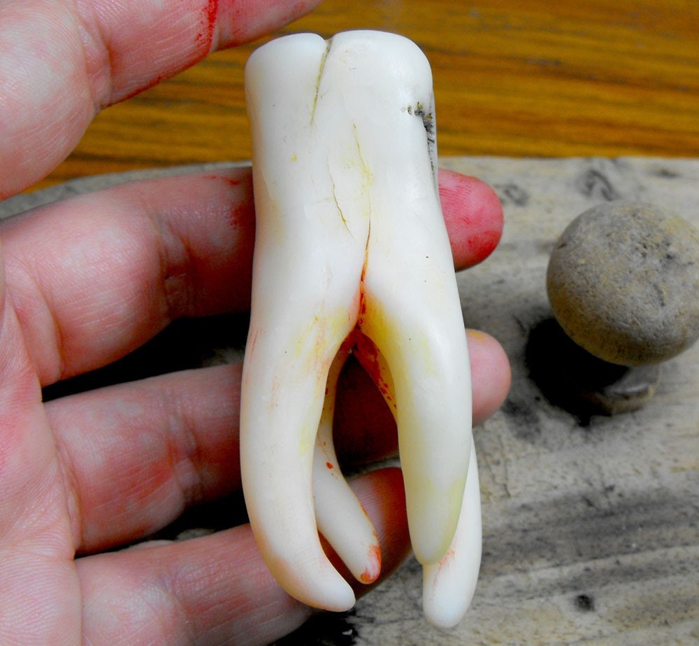 Super size human tooth XXL. The spectacular by themonsterofmyheart