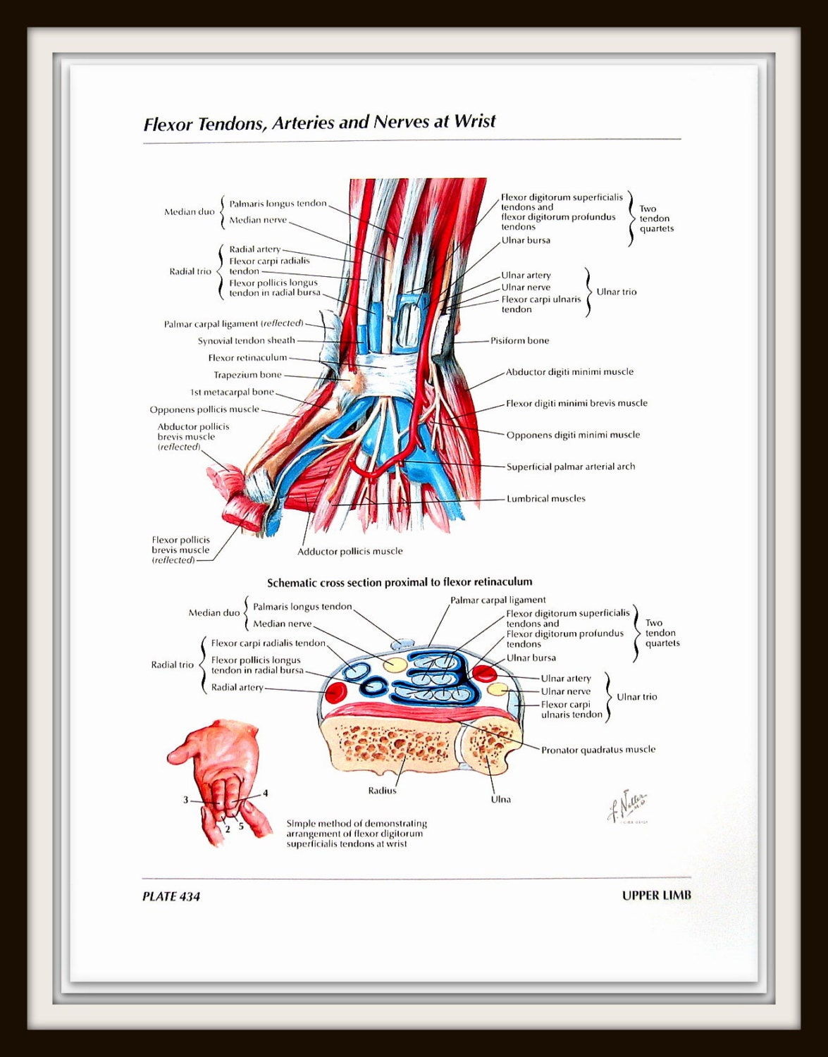 Anatomie Print poignet main Dissections palmaire Tendons
