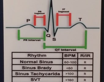 12 lead EKG tool ID Reference Card by STATreference on Etsy