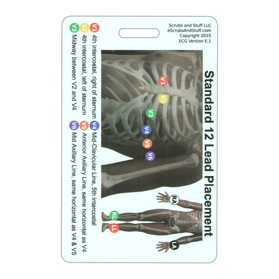 EKG 12 Lead Placement Vertical Badge Card