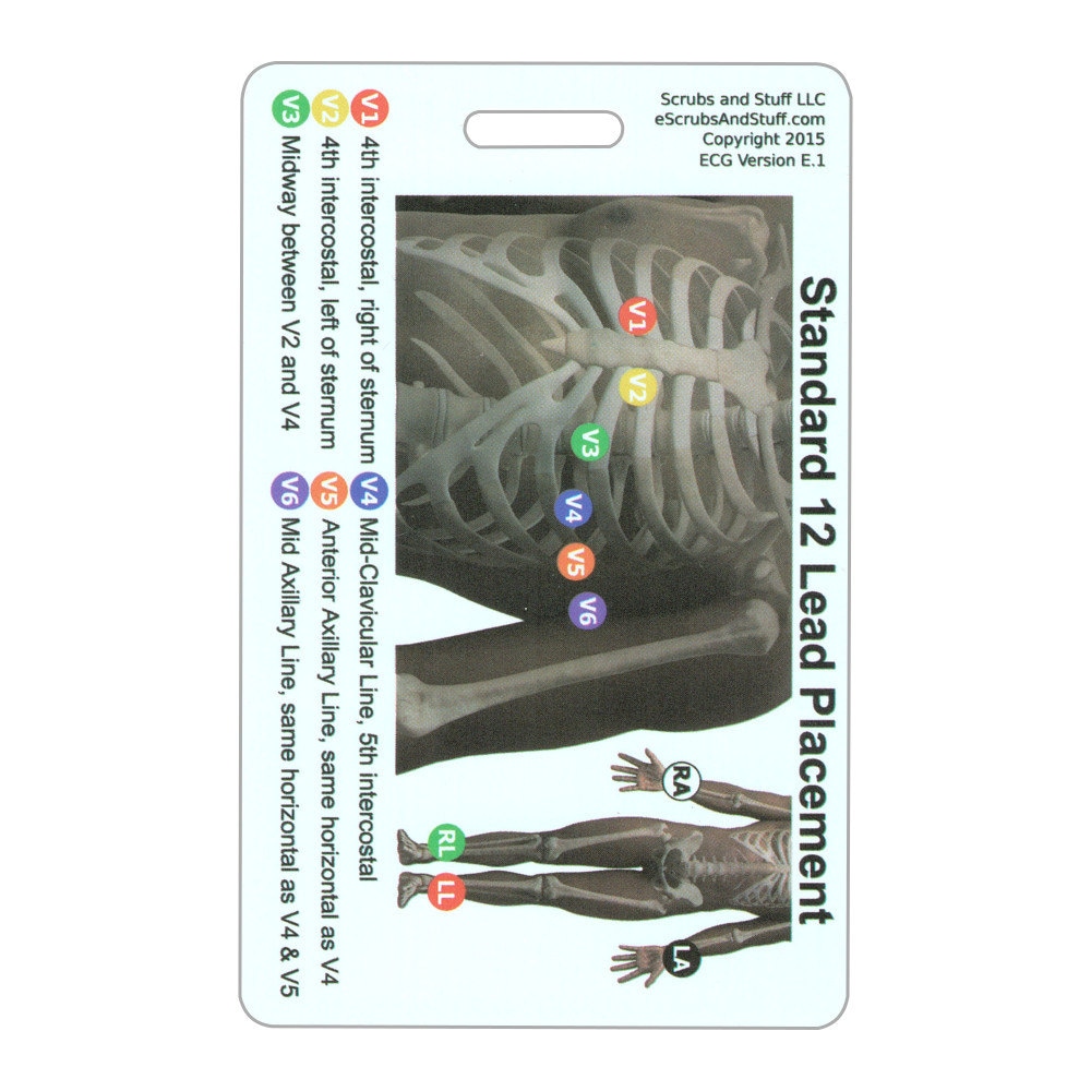 EKG 12 Lead Placement Vertical Badge Card