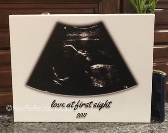 Ultrasound print | Etsy