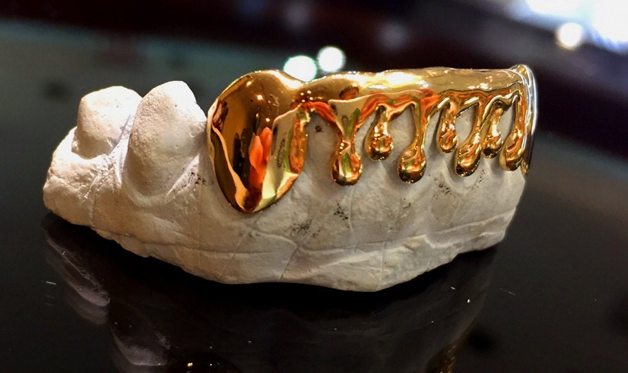 10k solid real yellow gold drip style grill dripping grillz
